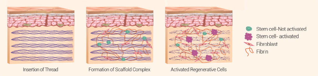 Product Thread N-Scaffold – N-Finders