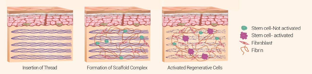 Product Thread N-Scaffold – N-Finders
